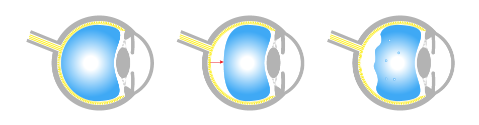 Augenarzt Dr. Pickl im Zentrum von Linz - Alle Kassen und privat